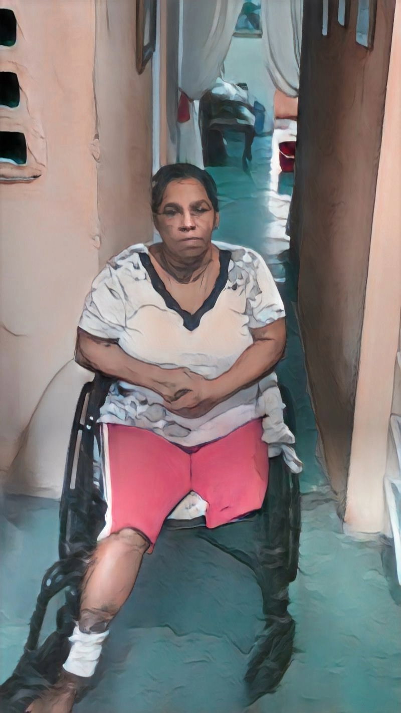 Mujer con pierna amputada denuncia desvinculación de MINERD y riesgo de ...